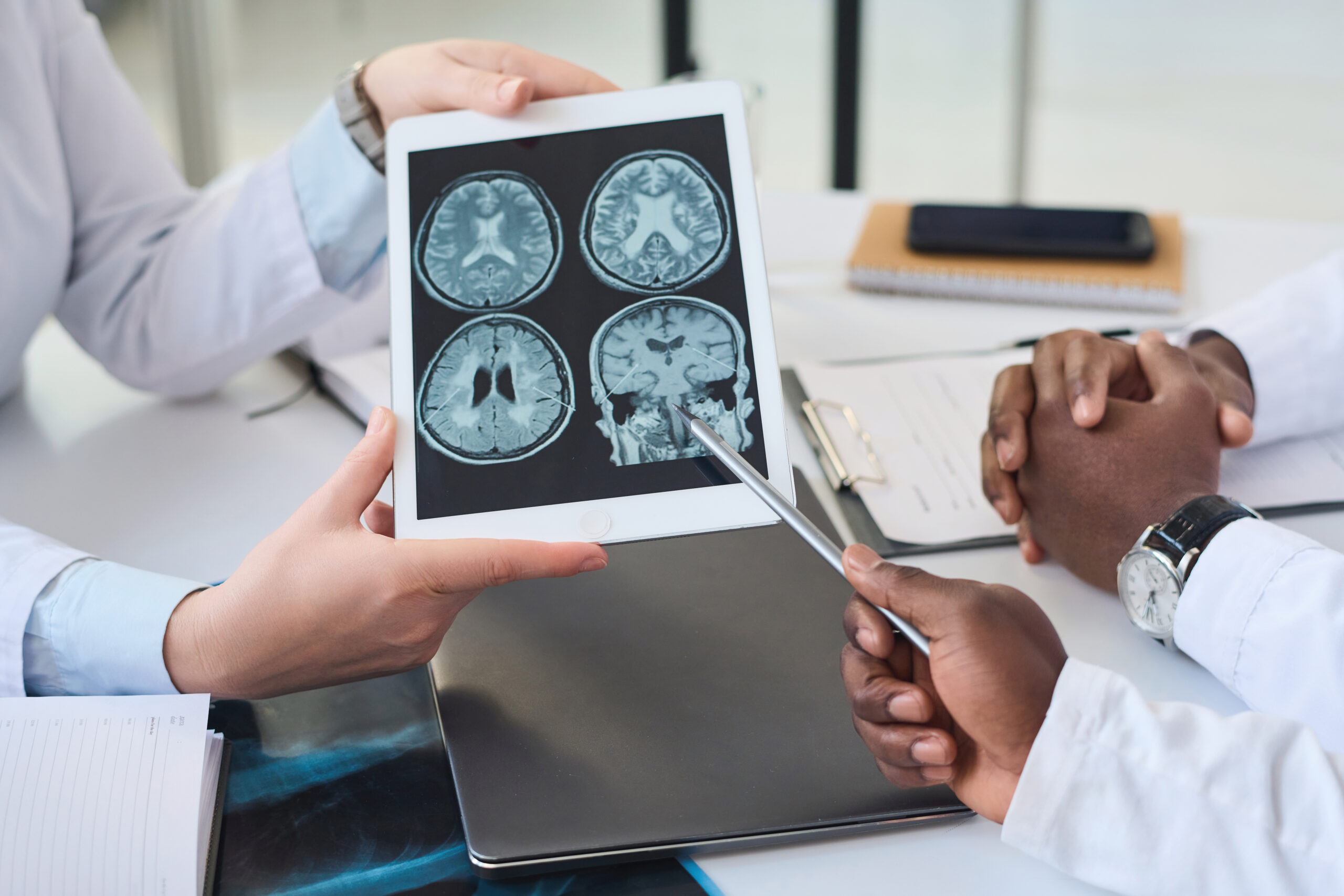 TBI Diagnosis After Accidents: Know the Signs and Tests